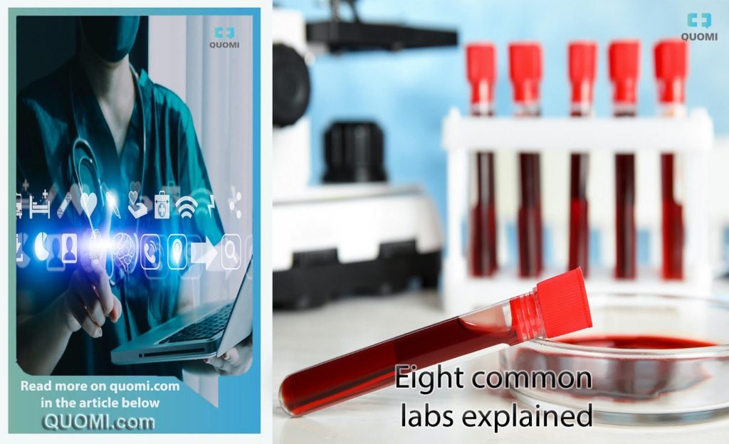 Eight Common Labs Explained - Quomi - Healthcare meets Social
