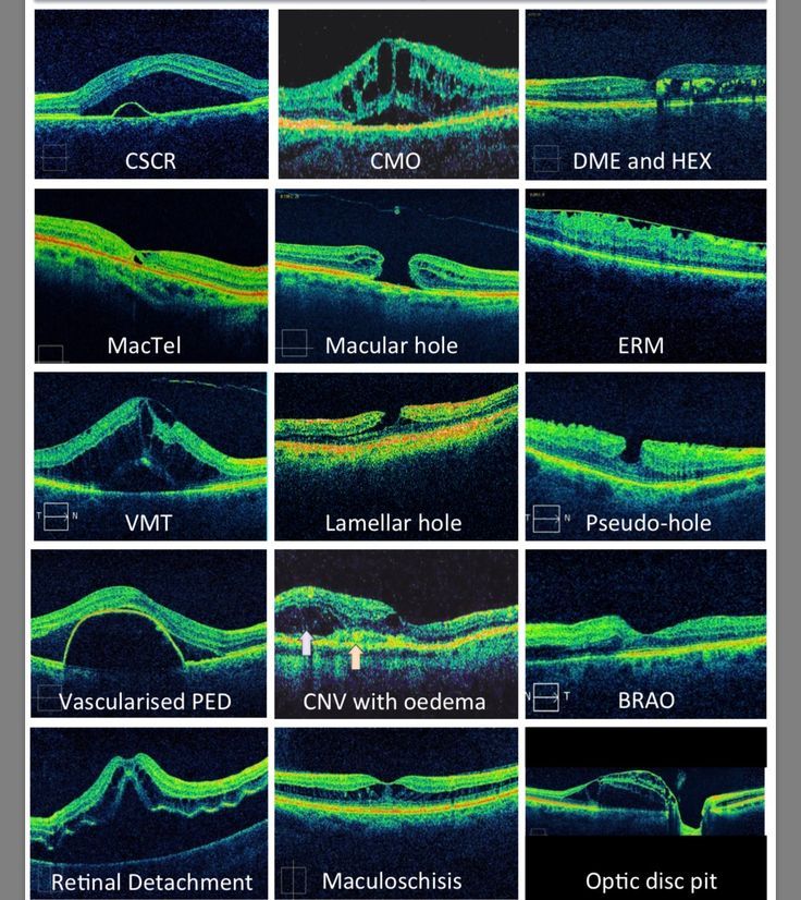 Simple OCt Roadmap – Quomi – Healthcare meets Social