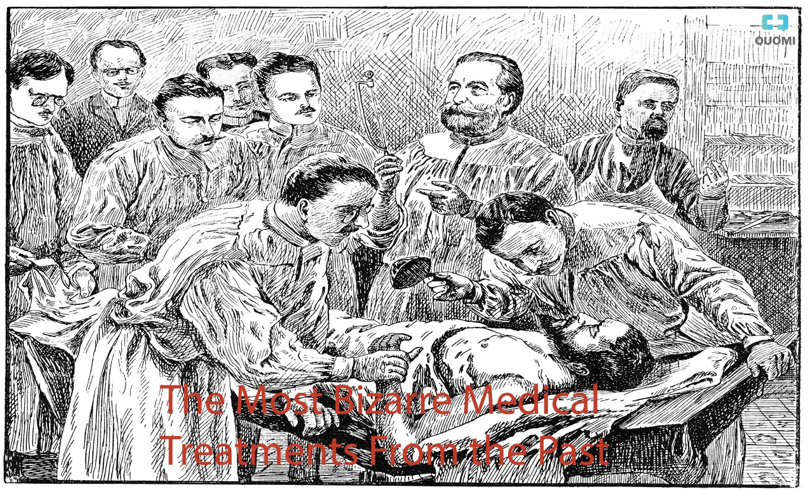 The Most Bizarre Medical Treatments From the Past - Quomi - Healthcare ...
