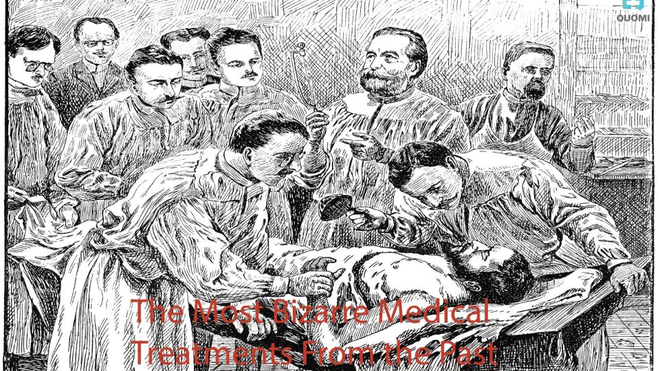 The Most Bizarre Medical Treatments From the Past - Quomi - Healthcare ...