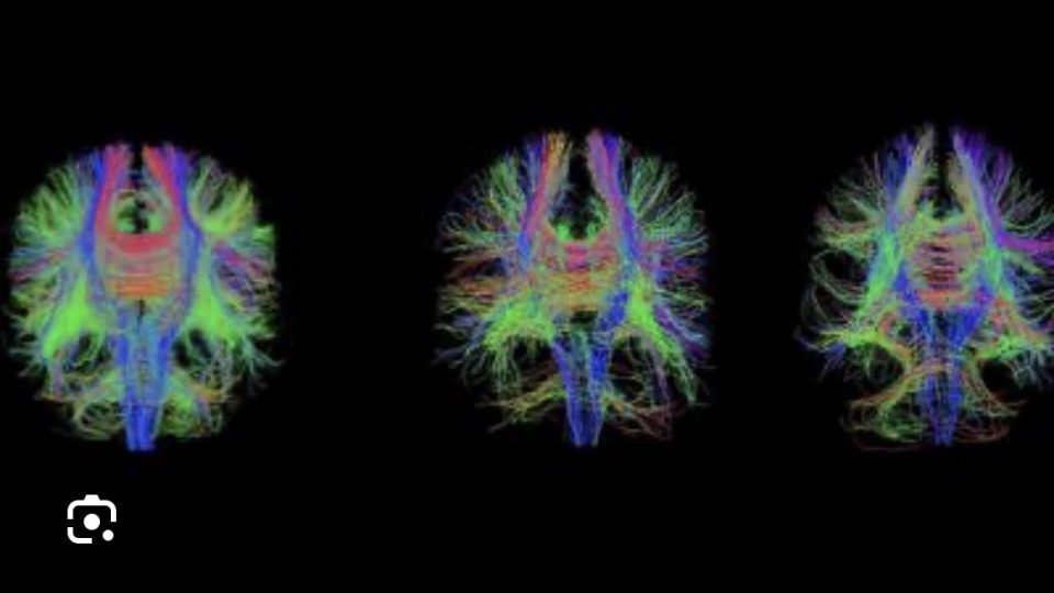 When music lights up the brain: insights from fMRI – Quomi – Healthcare ...