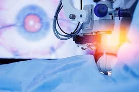 Adapting eye-laser technology to remove cancer - Quomi - Healthcare ...